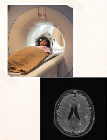 MRI scan for Brain Stroke Protocol | Hyderabad | Medifyhome